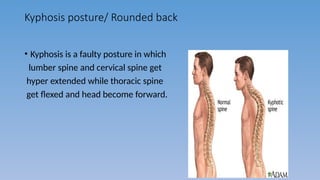 POSTURE.pptxiighhhhgghhgffghuuhggttdfggh | PPT | Free Download