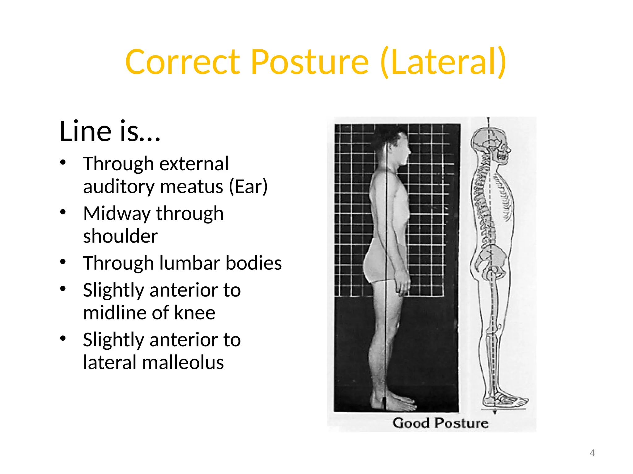 Various posture and spinal deformities.pptx