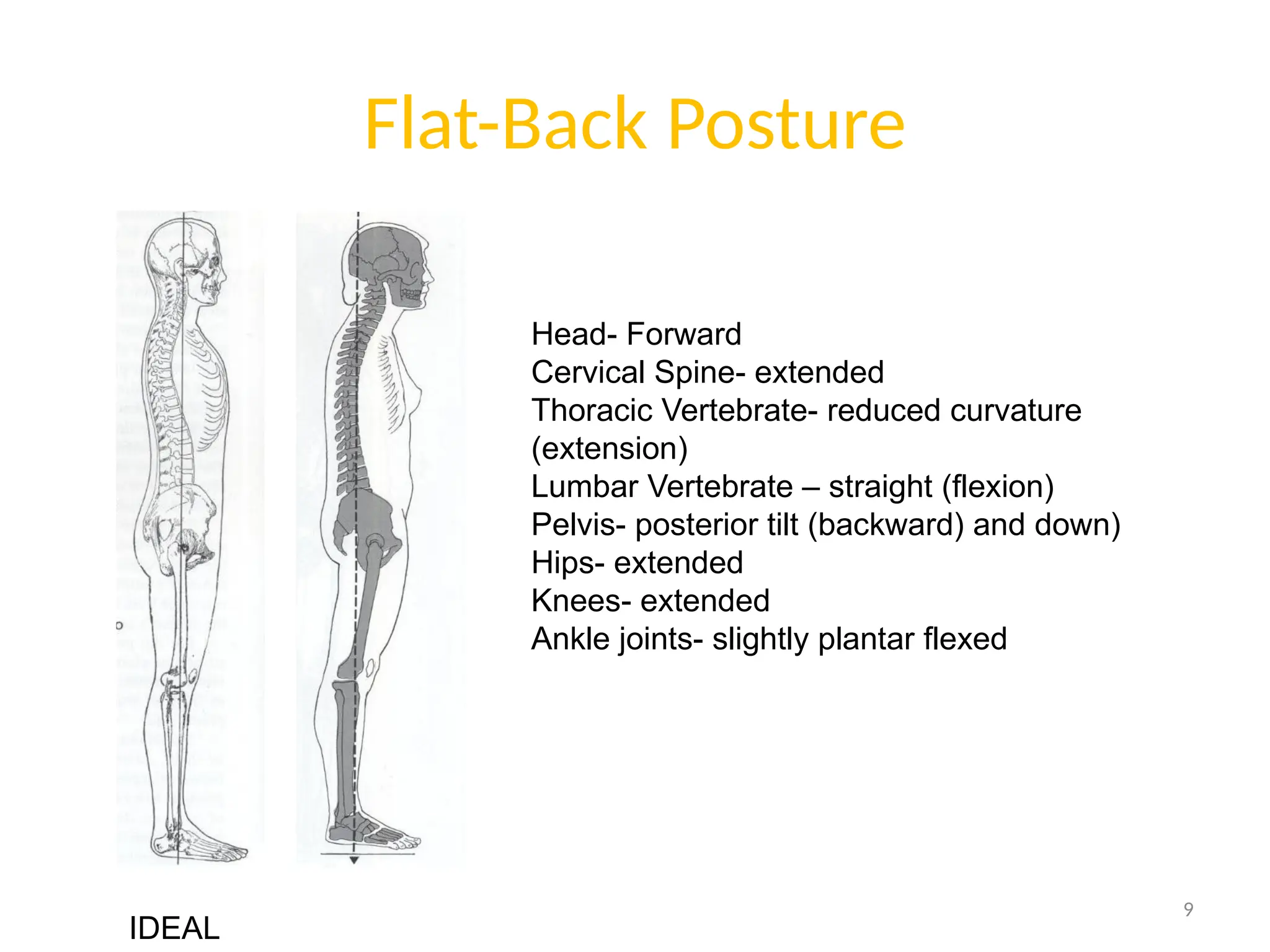 Various posture and spinal deformities.pptx