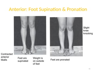 Various posture and spinal deformities.pptx