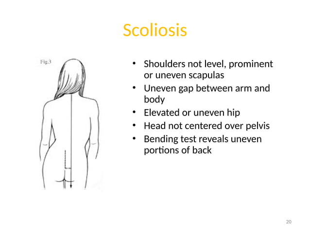 Various posture and spinal deformities.pptx