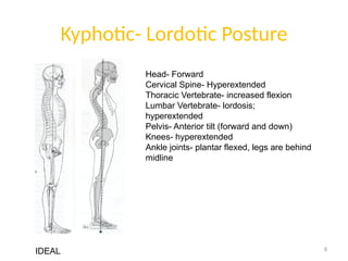 Various posture and spinal deformities.pptx