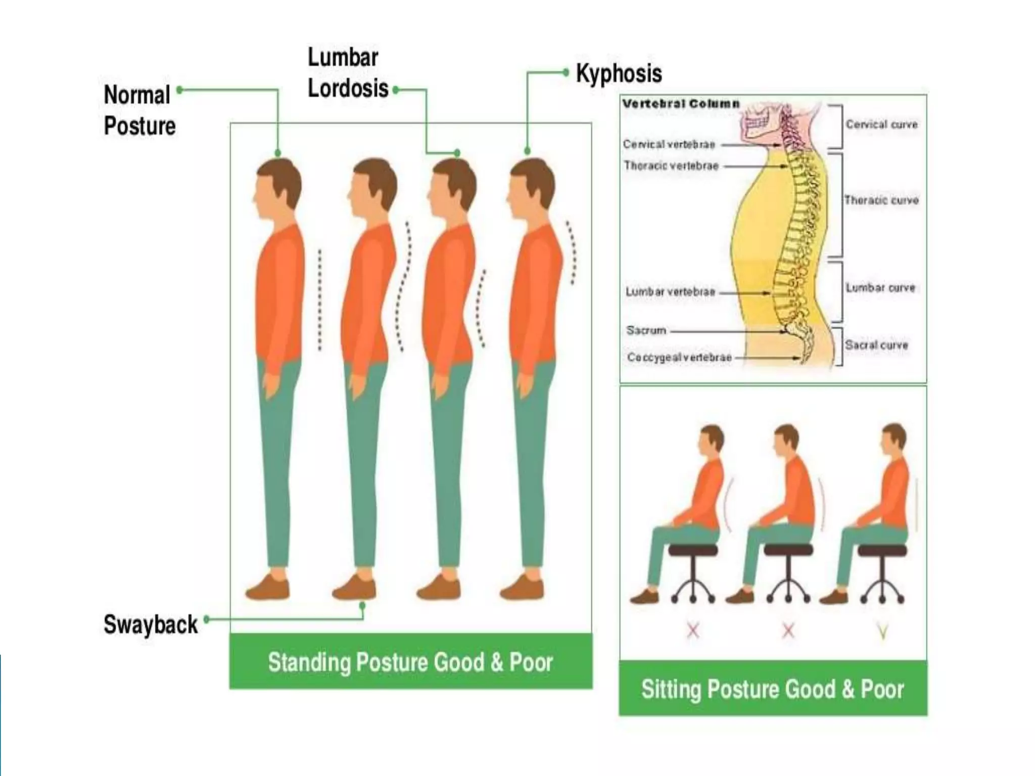 posture, cause, effect and remedial measures of bad posture | PPTX