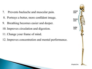 posture, cause, effect and remedial measures of bad posture | PPTX