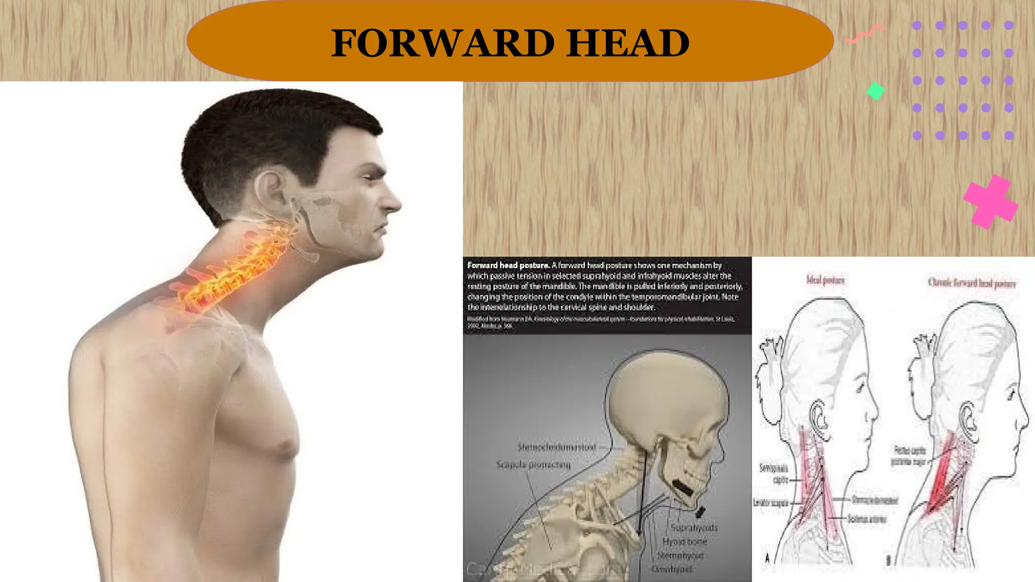 POSTURE and postural defects - GRADE8.pptx