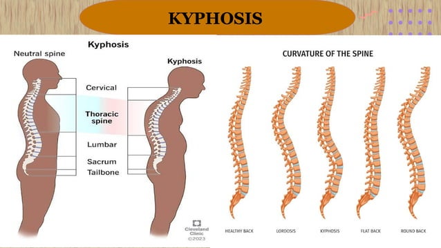 POSTURE and postural defects - GRADE8.pptx