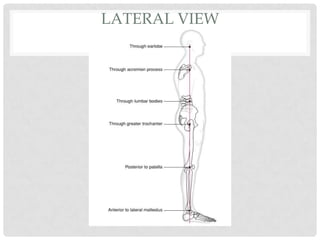 Posture analysis | PPTX