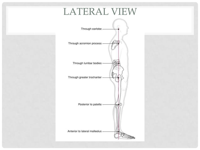 Posture analysis | PPTX | Death, Injury, or Military Conflict ...