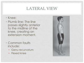 Posture Plumb Line Posterior