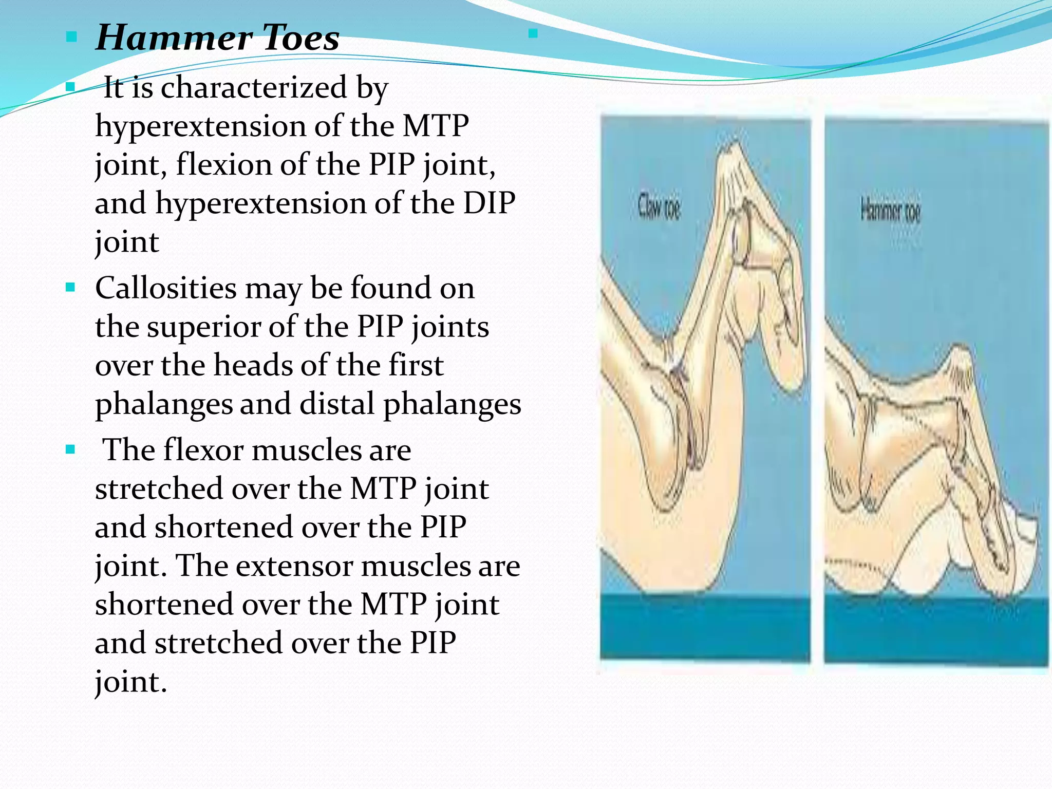 Posture Analysis In Biomechanics | PPTX