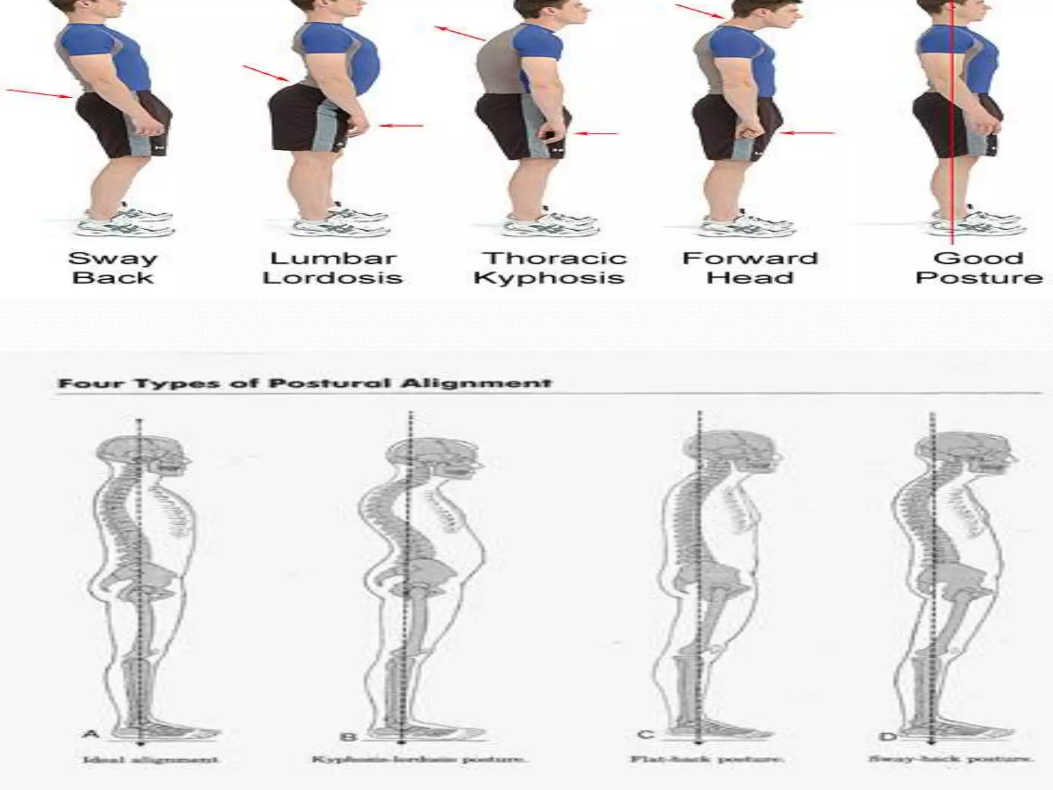 Posture Analysis In Biomechanics | PPTX