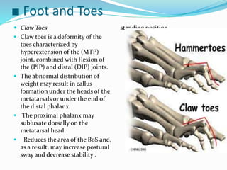 Posture Analysis In Biomechanics | PPTX