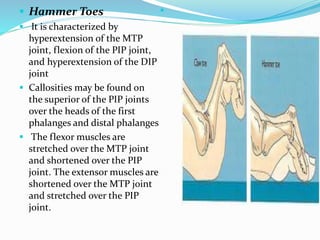 Posture Analysis In Biomechanics | PPTX