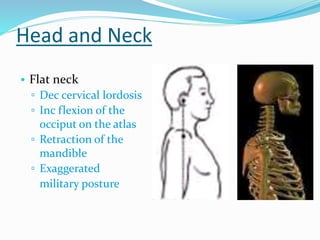 Posture Analysis In Biomechanics | PPTX