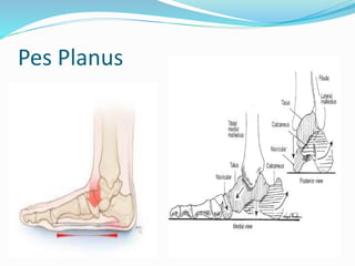 Posture Analysis In Biomechanics | PPTX