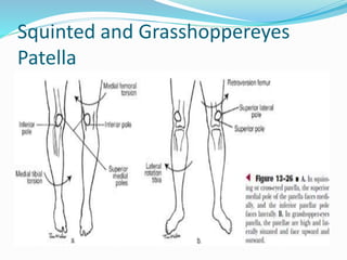 Grasshopper Patella