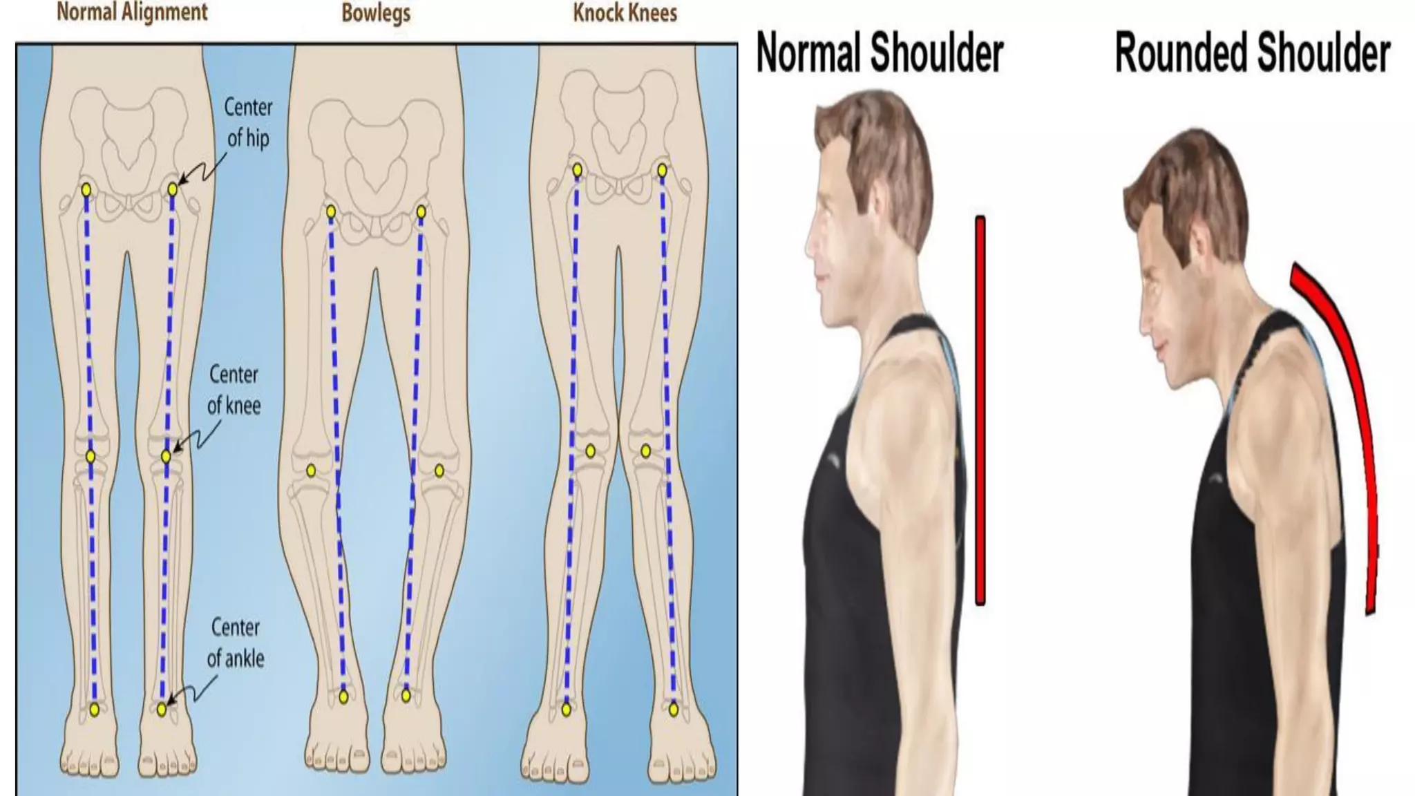 POSTURE AND ATHLETE care.pdf