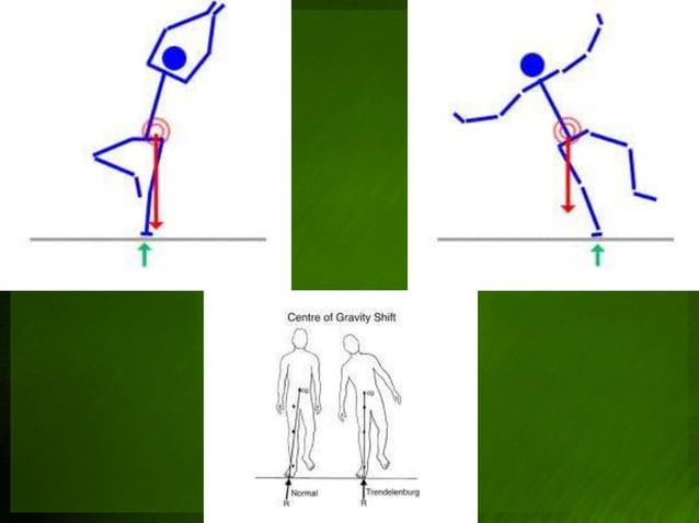 POSTURAL CONTROL AND MOVEMENT SYSTEMS.pptx