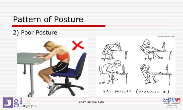 POSTURE AND PAIN - Gisurgery.info