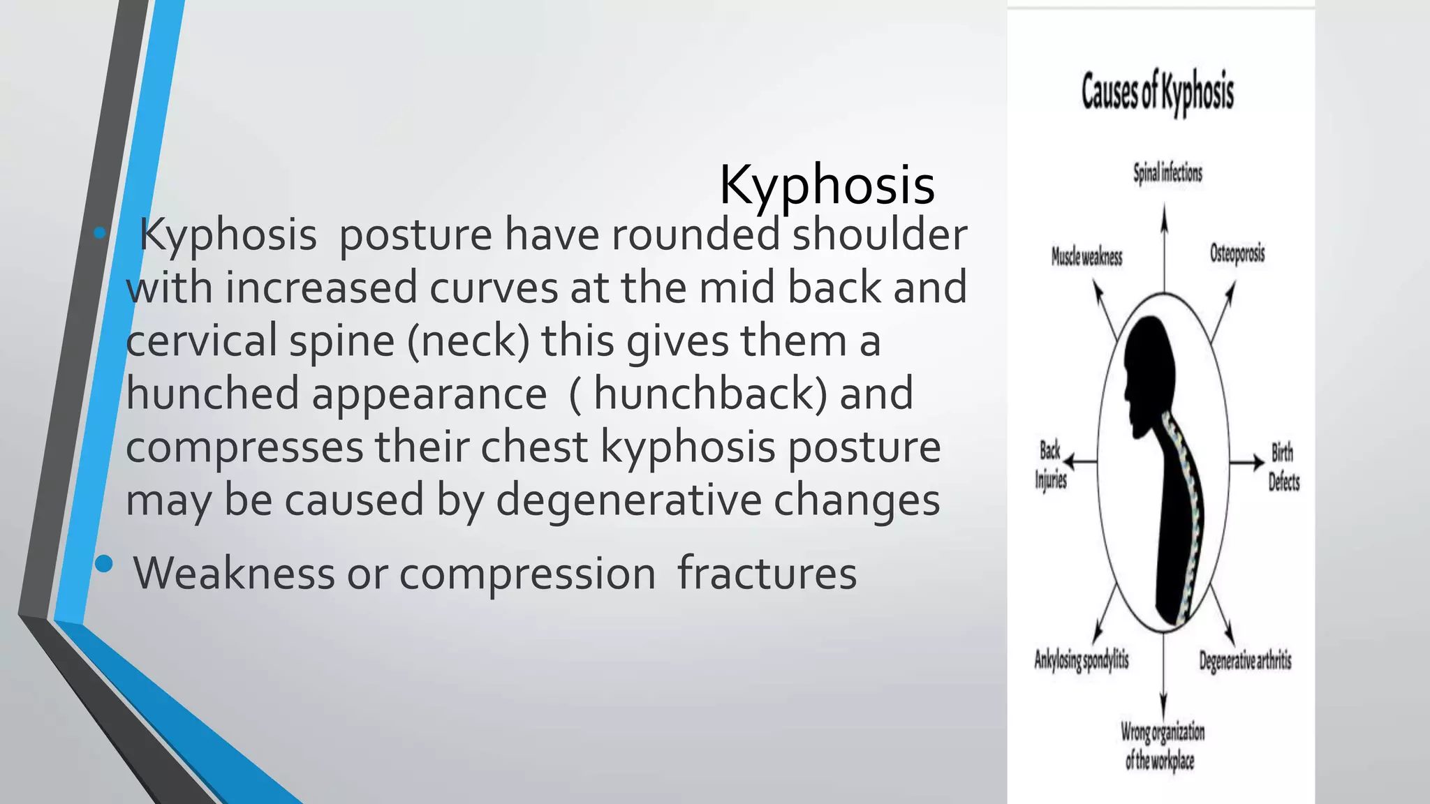 posture assessment.pptx