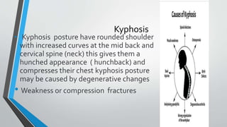 posture assessment.pptx