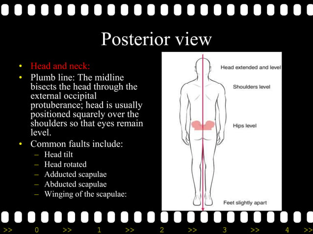 Posture assessment cpd | PPTX | Death, Injury, or Military Conflict ...