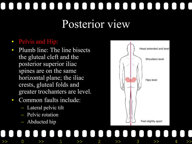 Posture assessment cpd | PPTX | Death, Injury, or Military Conflict ...