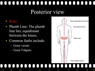 Posture Plumb Line Posterior