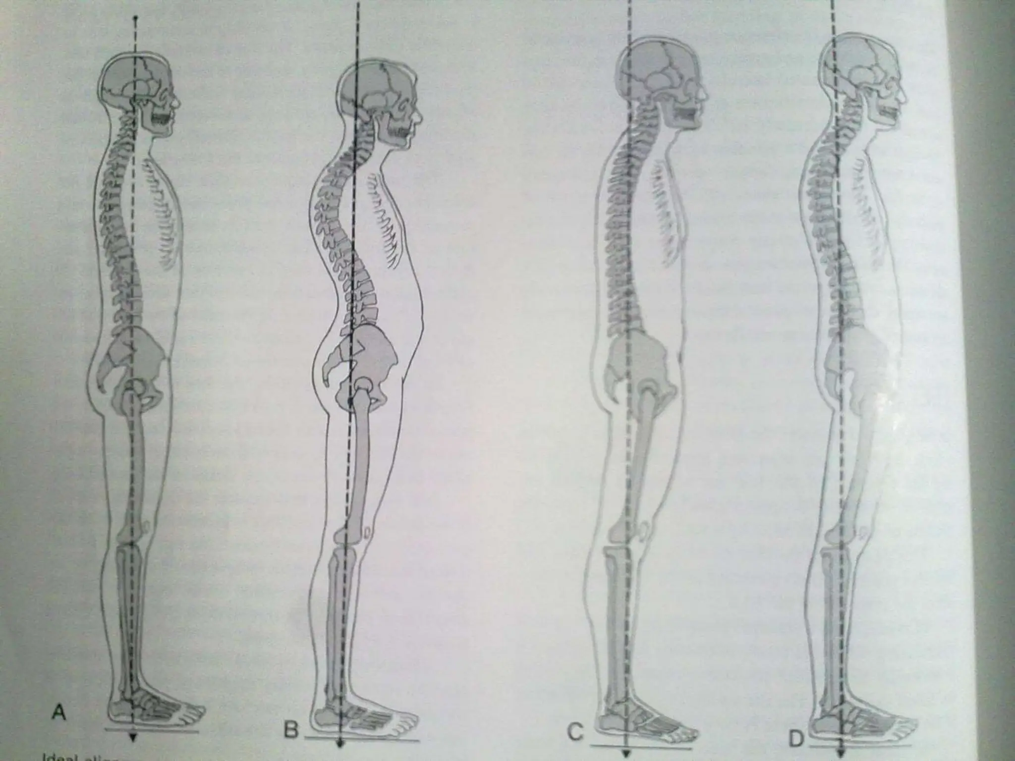 postural assessment presentation_2010.pptx