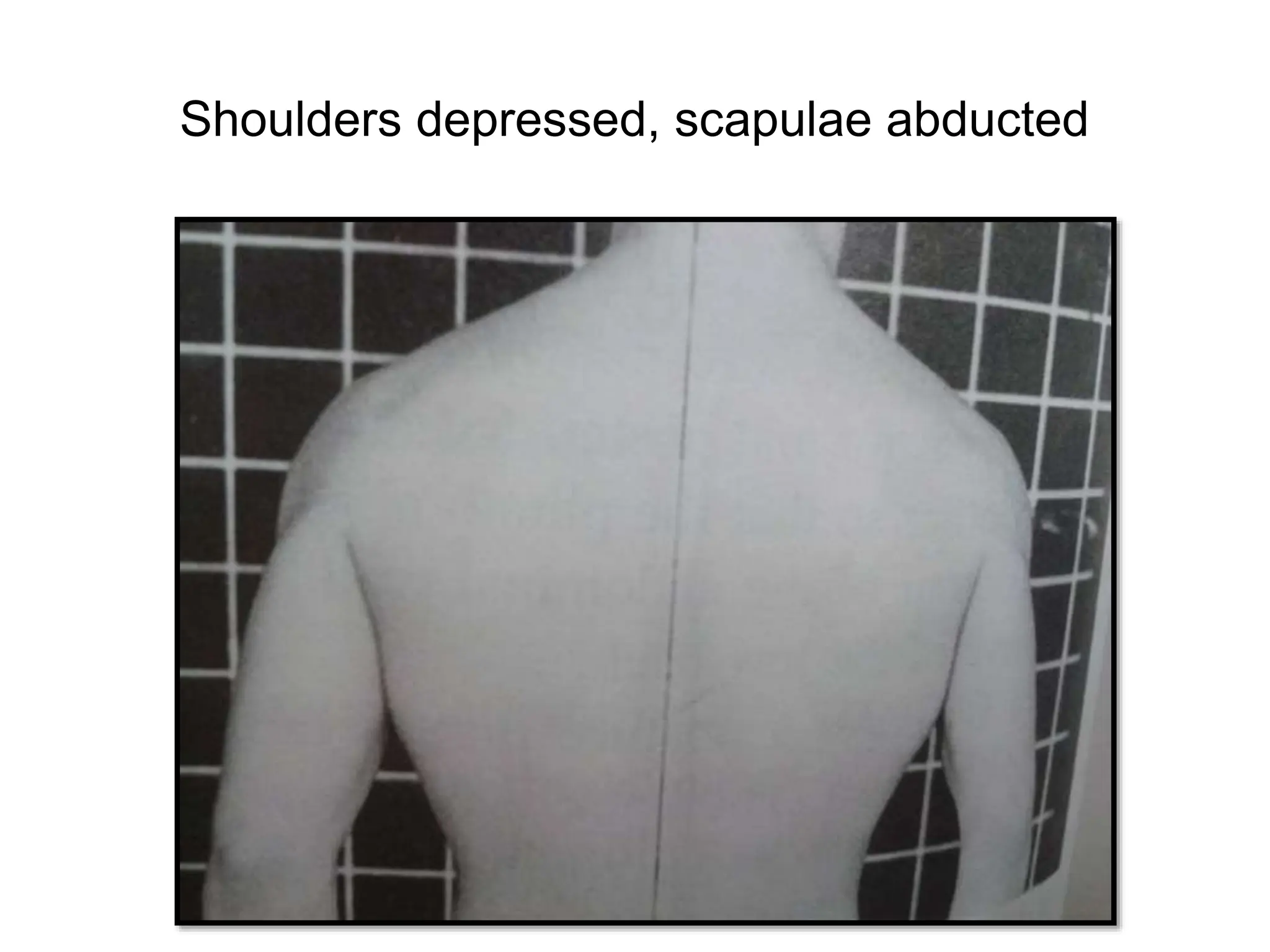 postural assessment presentation_2010.pptx