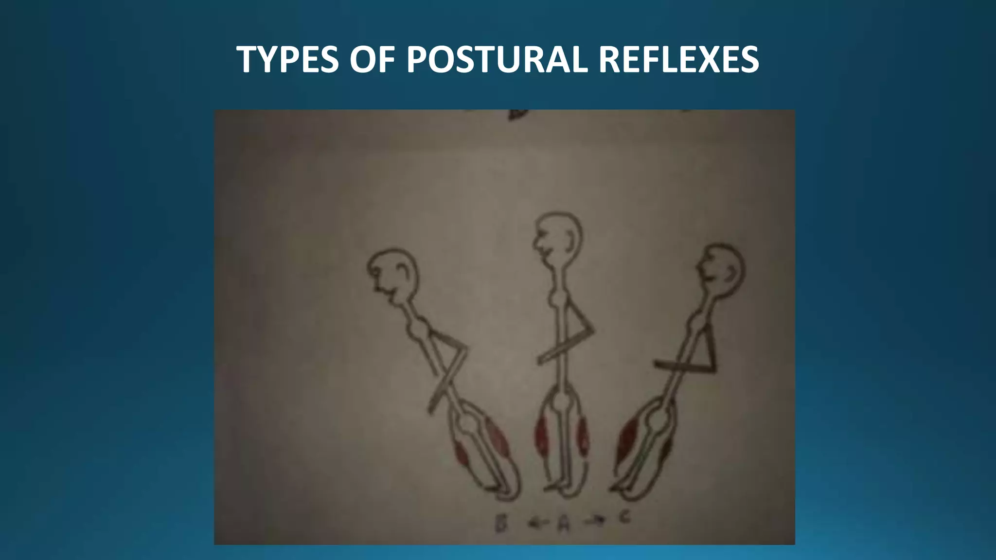 Postural reflexes Physiology | PPTX