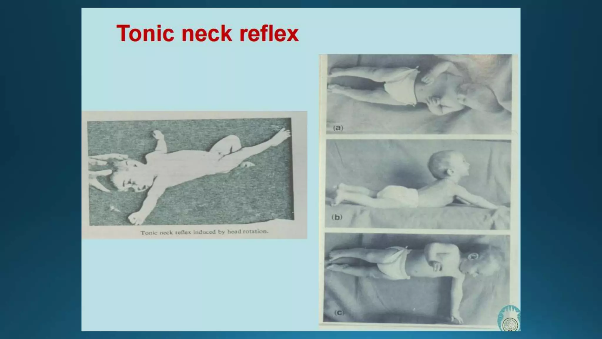 Postural reflexes Physiology