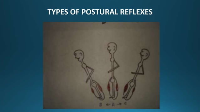 Postural reflexes Physiology | PPTX