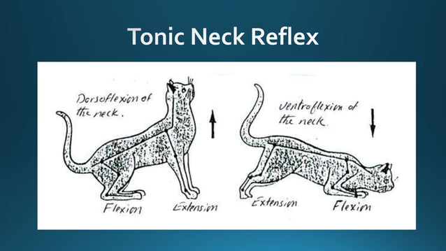 Postural reflexes Physiology | PPTX