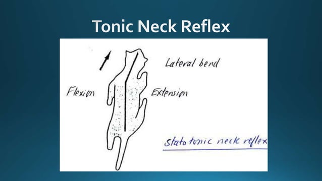 Postural reflexes Physiology | PPTX