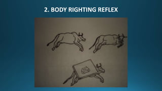 Postural reflexes Physiology | PPTX