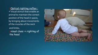 Optical Righting Reflex Infants