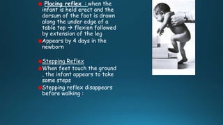 Placing Reflex