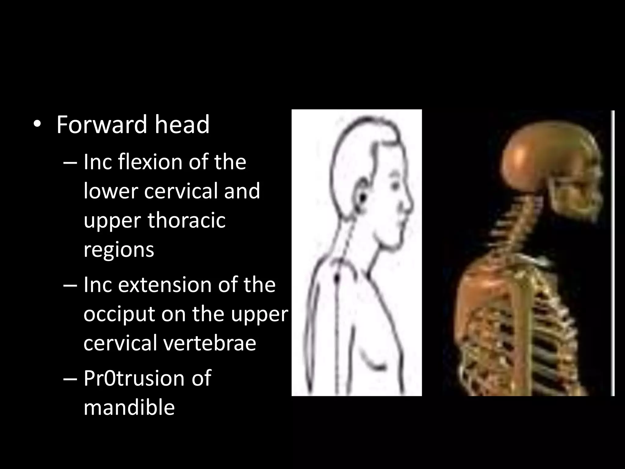 Posture in biomech.pptx