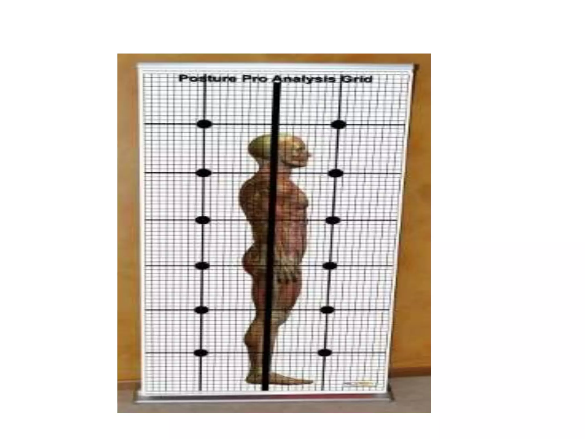 Postural analysis | PPTX