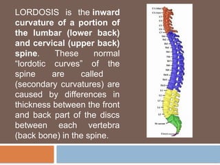 posture presentation by Amar Hussain pptx | PPT