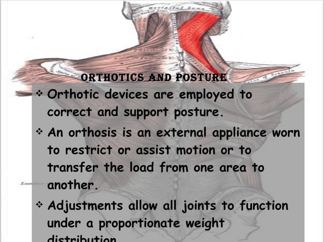 Posture | PPT | Physical Therapy | Wellness