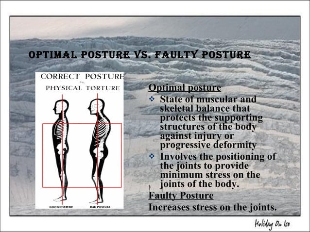 Posture | PPT | Physical Therapy | Wellness