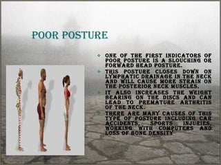 Posture | PPT | Physical Therapy | Wellness