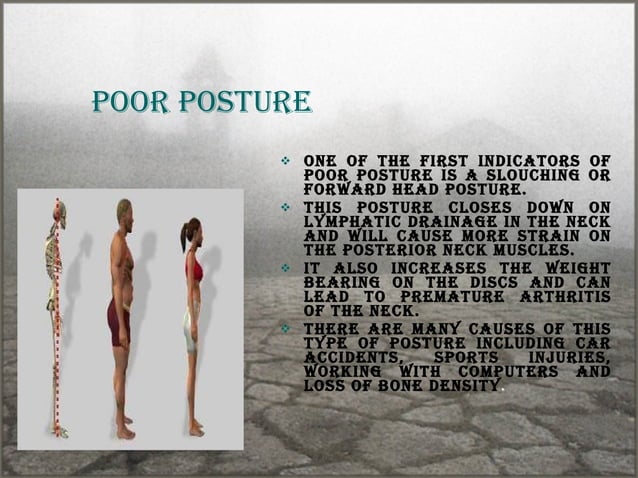 Posture | PPT | Physical Therapy | Wellness