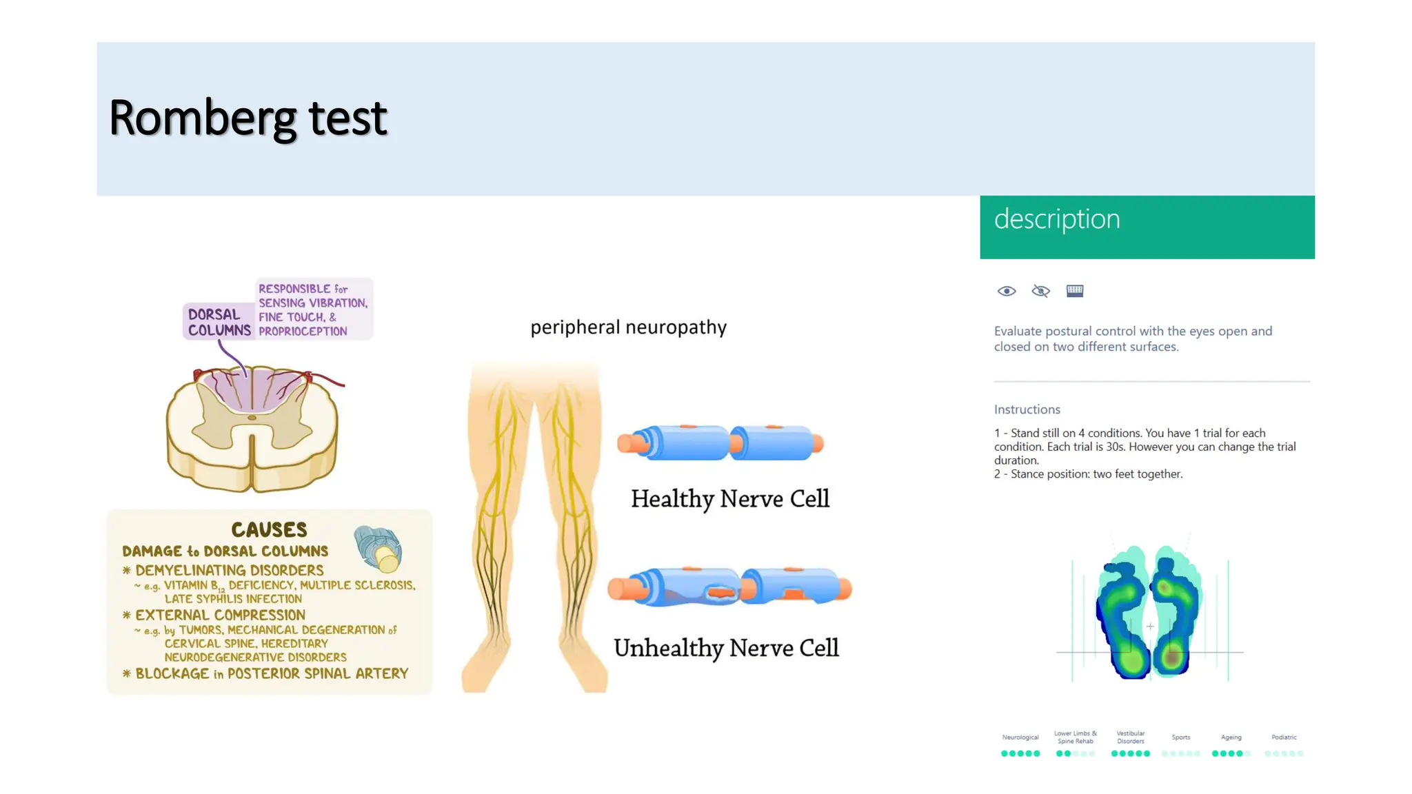 Posturography in Neurological Disorders - How to assess and treat ...