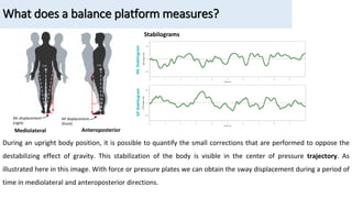 Posturography in Neurological Disorders - How to assess and treat ...