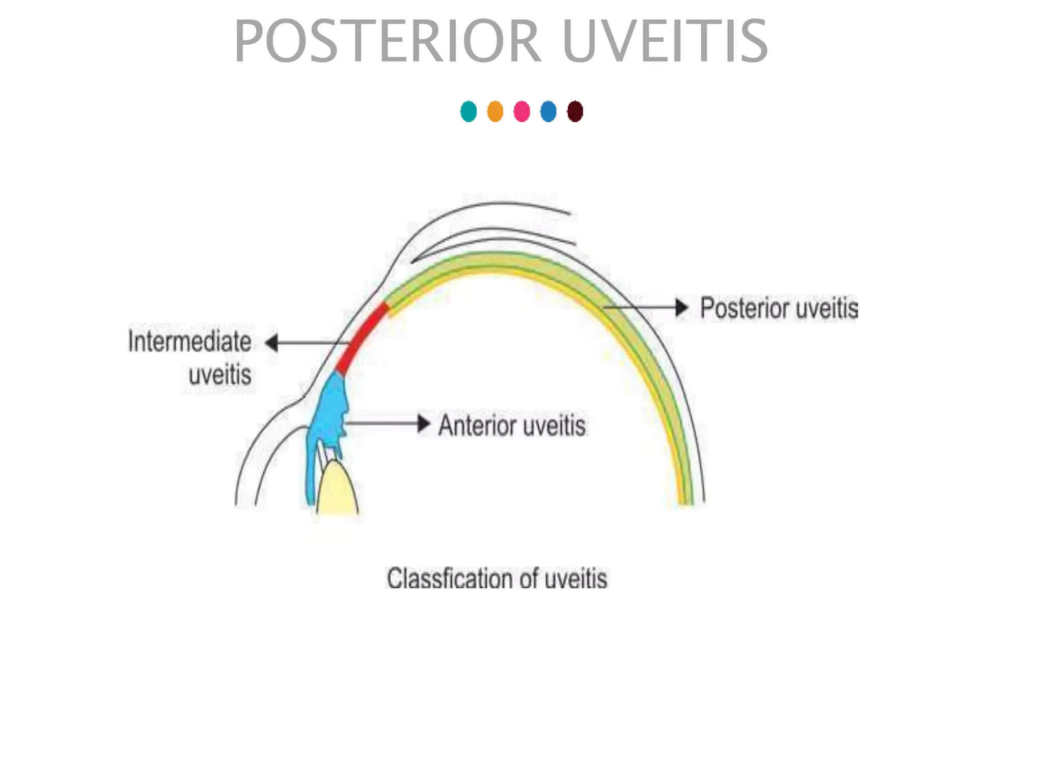 POST UVEITIS SEMINAR.pptx