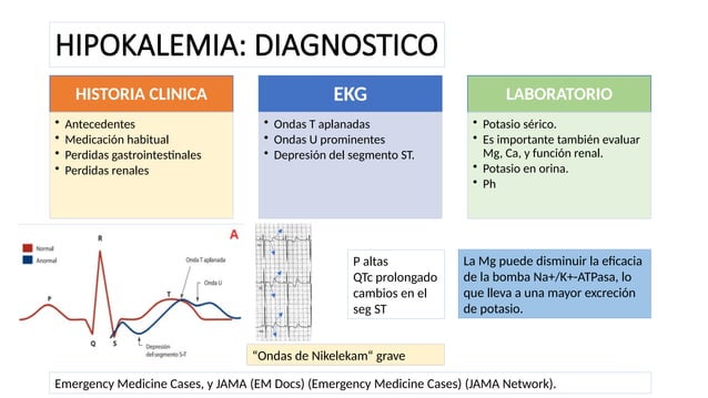 alteraciones del potasio hipokalemia e hiperkalemia | PPT