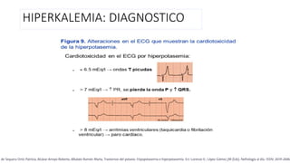 alteraciones del potasio hipokalemia e hiperkalemia | PPTX